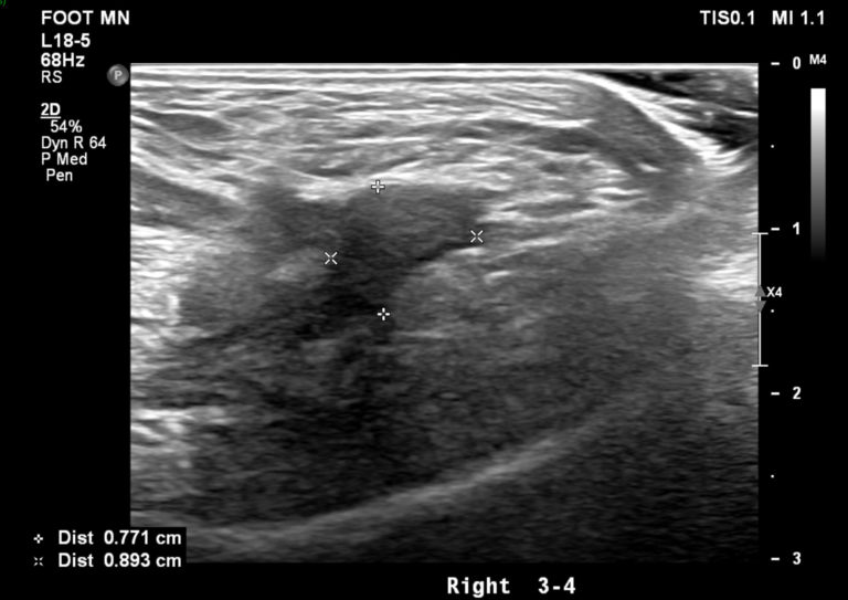 Case Study - Clinical Application of Sonography in Diagnosis and ...