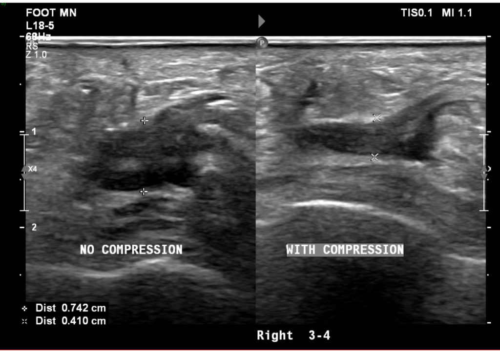 Case Study - Clinical Application of Sonography in Diagnosis and ...