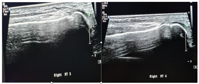 Case Study - Clinical Application of Sonography in Diagnosis and ...